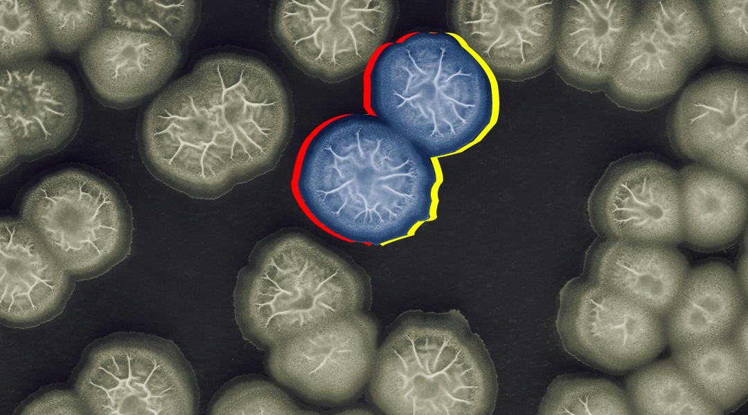 Chancroide: no, no es una infección de la era tecnológica - AHF Panamá